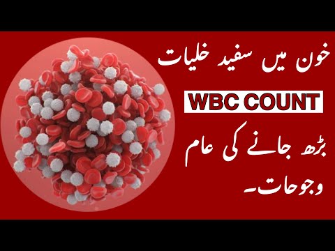 High White Blood Cell Count Urdu/Hindi | Common Causes Of High WBC Counts