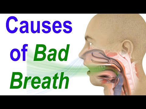 Sources of Bad Breath or Halitosis: Evaluate, Diagnose, and Treat