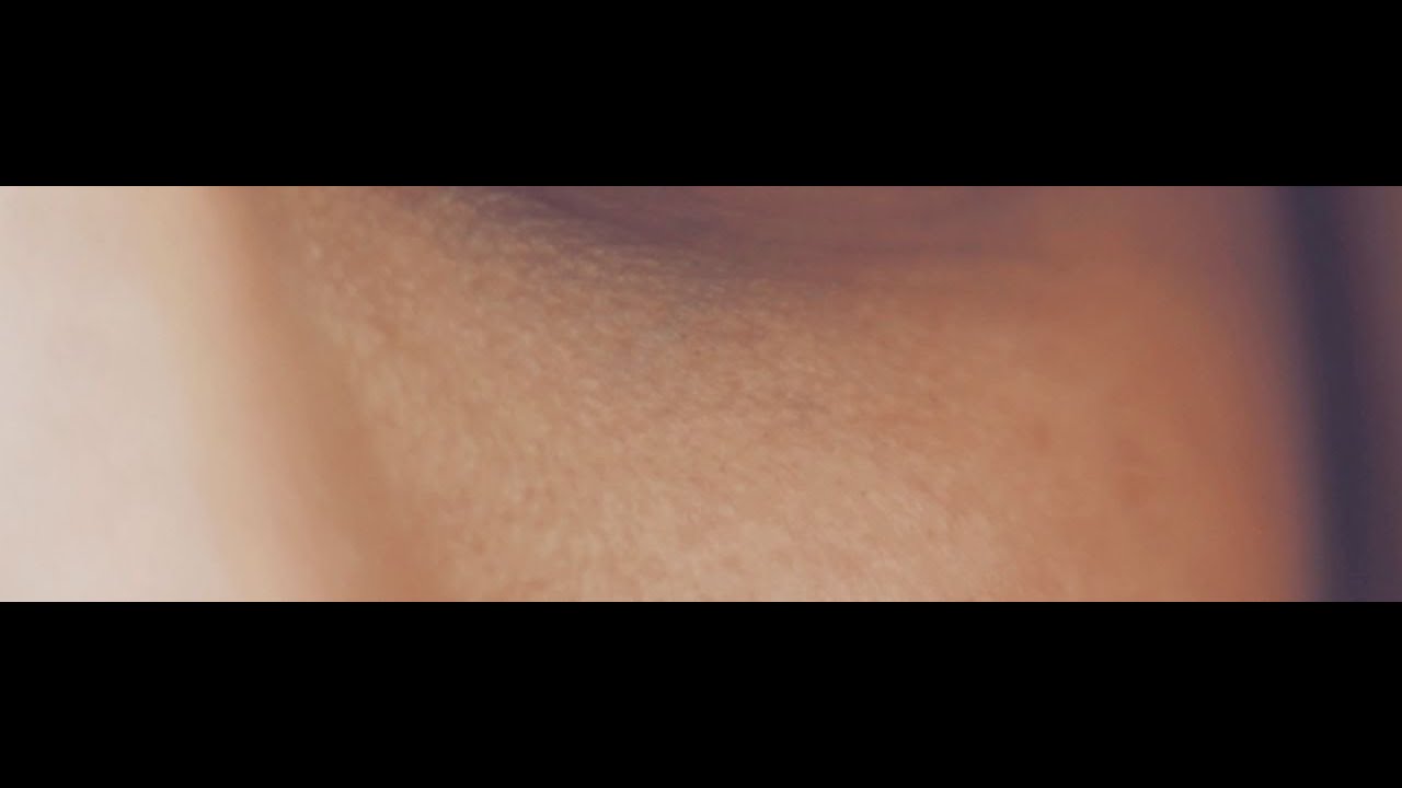 DARK CIRCLES UNDER EYES (FULL INTERVIEW 7 MINS)