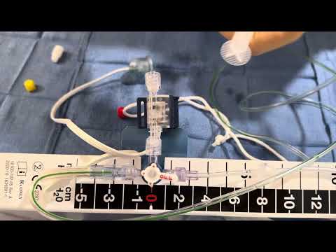 Setting Up Codman EVD System