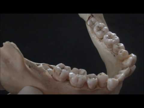 Bones of the skull - The Mandible - Human Anatomy Video