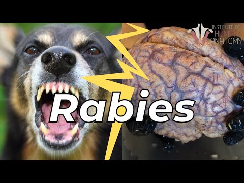 the rabies virus can cause real zombies | anatomy, science & medicine ...