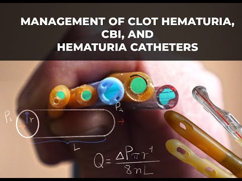 Management of Clot Urinary Retention, CBI, and hematuria catheters