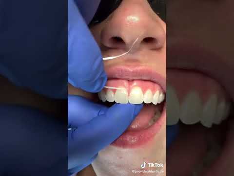 Are you going deep enough with your floss? #shorts