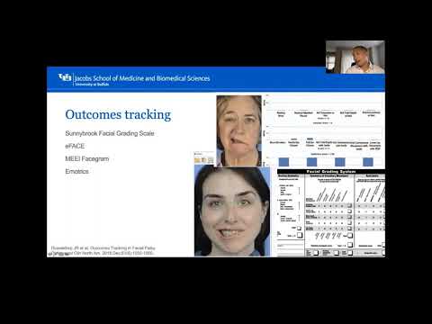 Acute Facial Palsy