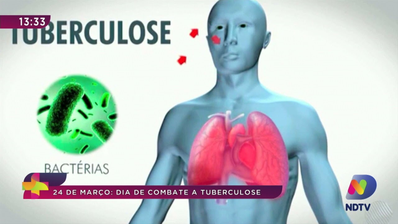 Ver Mais Saúde: Tuberculose mata uma pessoa a cada 21 segundos no mundo ...
