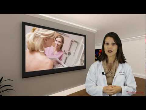 Breast Calcifications