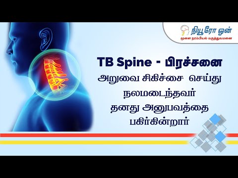 From Diagnosis to Recovery: Real Stories of Cervical TB Spine Surgery
