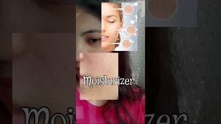 Best top 5 moisturizer for dry skin