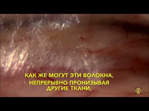 "Strolling under the skin"/ Прогулка под кожей