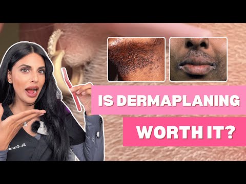 Is dermaplaning worth it for Melanin-rich skin? -Doctor explained