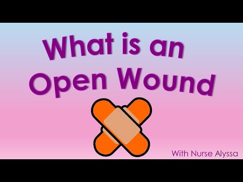 What is an Open Wound?