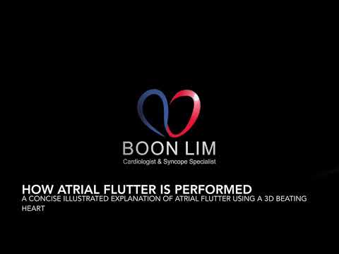 Atrial Flutter Ablation : A concise illustrated video explaining how atrial flutter is performed.