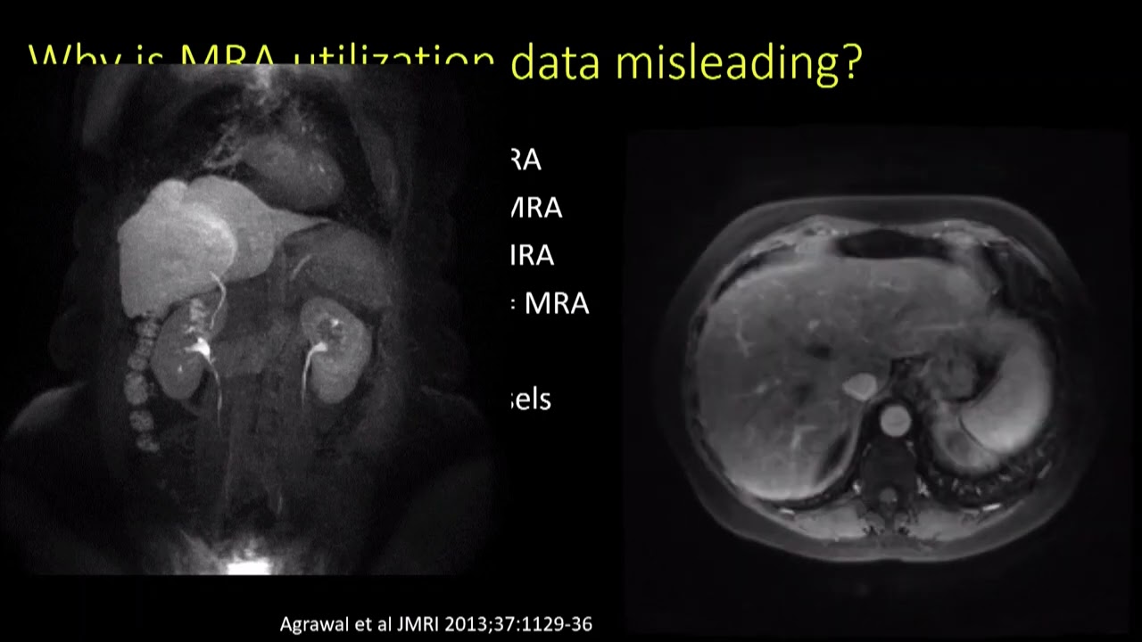 PlenarySession I 4 When and Why I Choose MRA over CTA   Presented by Martin Prince
