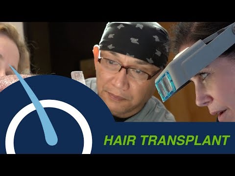 Technician's Husband Gets a Hair Transplant!