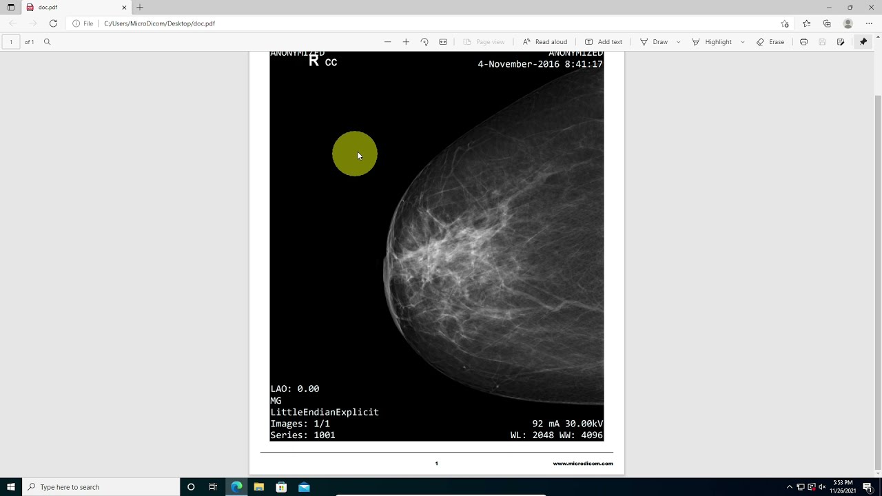 DICOM to PDF