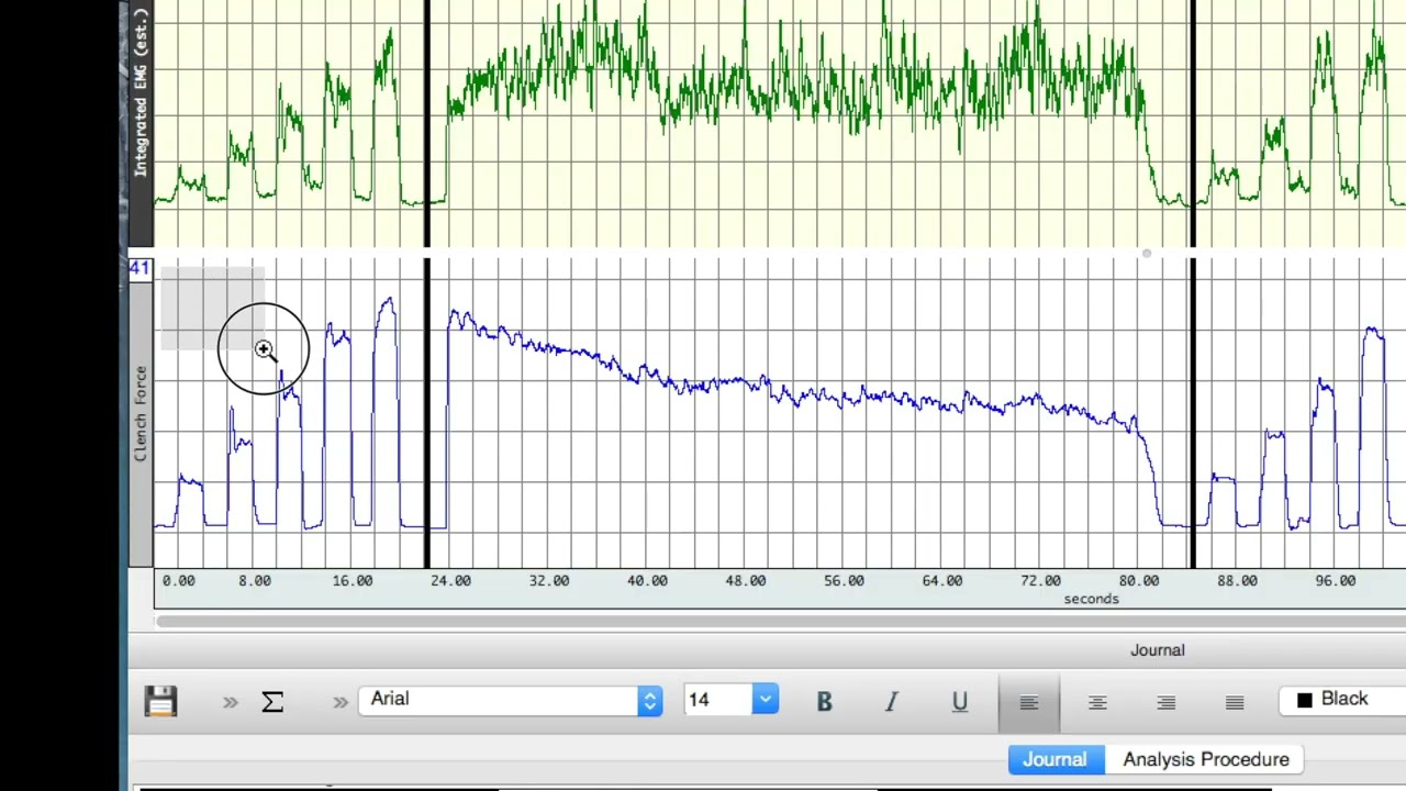 EMG Data Analysis Video