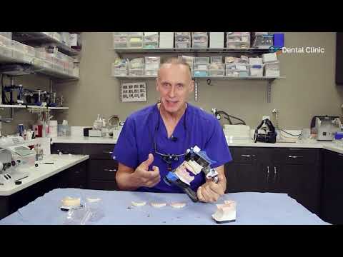 All On 4 vs  Implant Bridges Explained In The Lab