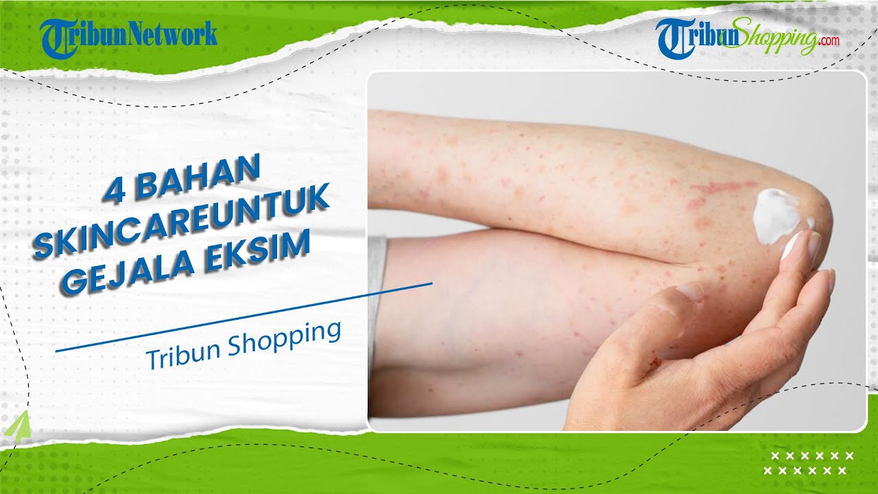 Simak Penjelasan 4 Bahan Skincare yang Bisa Meredakan Gejala Eksim pada ...