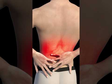 This is a bulging Disc #shorts #back #anatomy