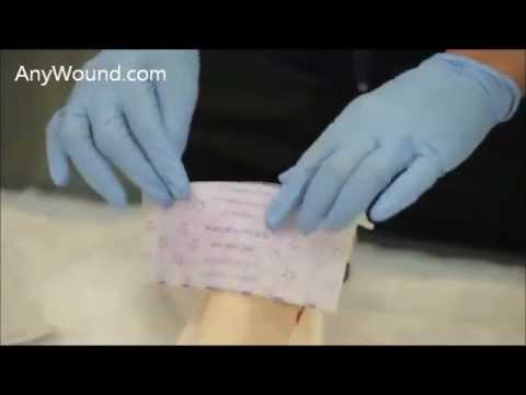 Self-Adaptive wound dressing Application on Full Thickness Heel Wound (Model)
