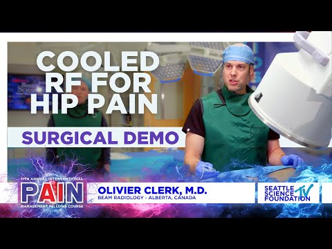 Cooled RF for Hip Pain - Olivier Clerk, M.D.