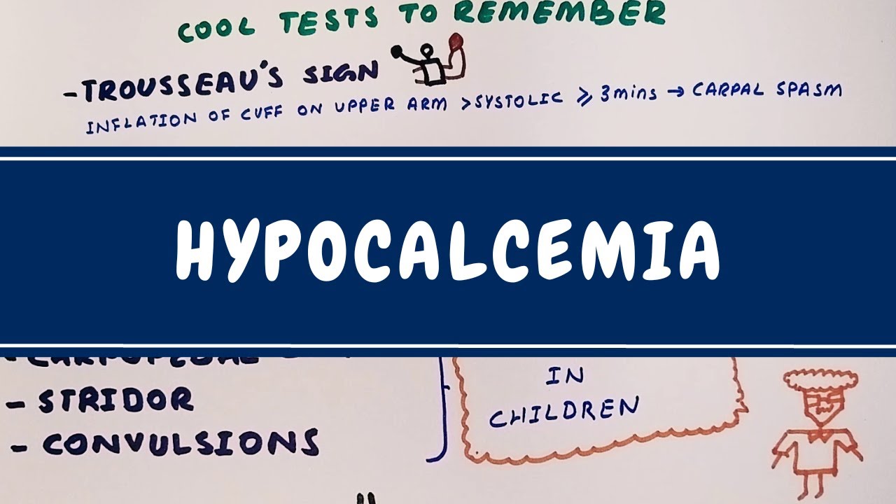 Hypocalcemia made easy (definition,pathophysiology,causes,symptoms,comps,diagnosis,management)
