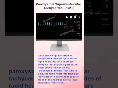 Paroxysmal Supraventricular Tachycardia (PSVT)