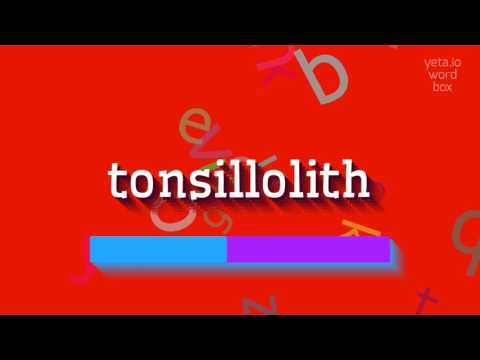 How to say "tonsillolith"! (High Quality Voices)