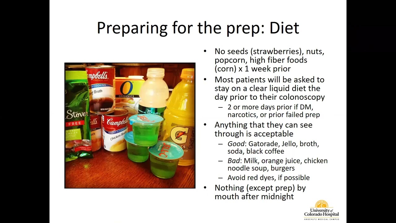 Keys to a Successful Bowel Prep for Colonoscopy: Tips and Tricks for Patient Navigators (2019)
