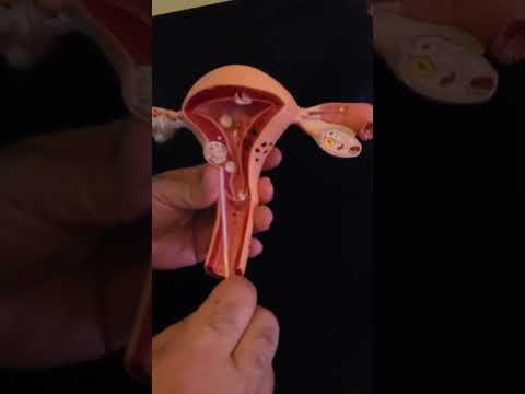 how do we get a uterine endometrial biopsy?