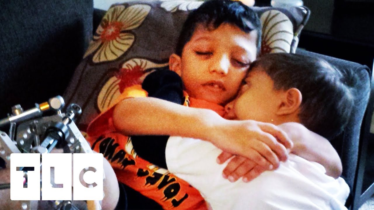 The Brothers with Bendy Bones | Body Bizarre