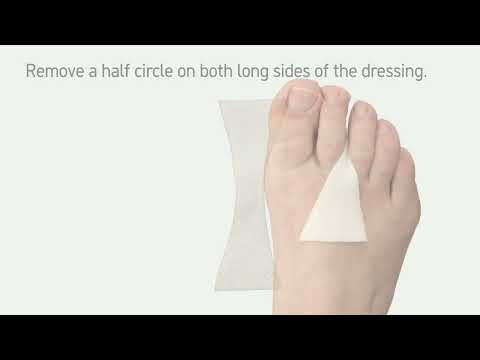 How to apply Mepilex Transfer between the toes