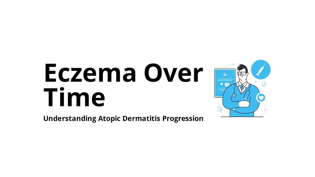 How does eczema (atopic dermatitis) develop over time?