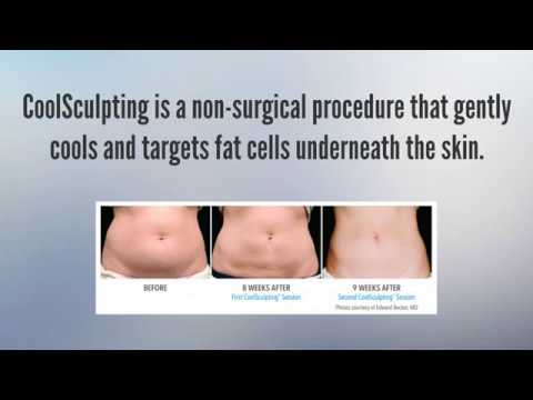 Body Contouring El Paso, TX | CoolSculpting at El Paso Cosmetic Surgery