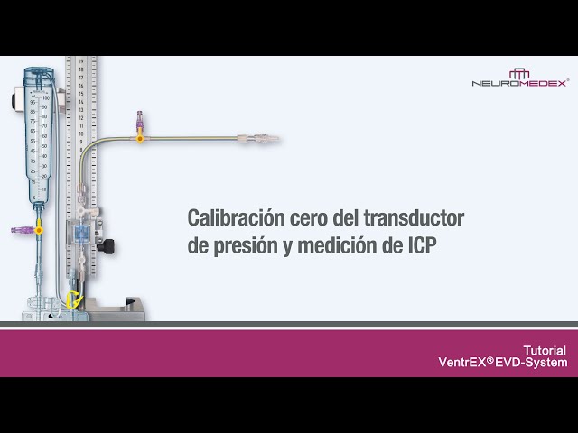 VentrEX® EVD | Ventrex