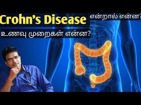Crohn's disease explanation in tamil/medical awareness in tamil