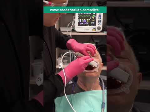 Intraoral Photogrammetry the Aoral Elite Scanner #shorts