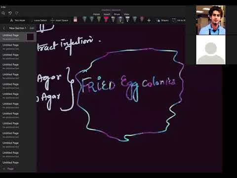 Live Classroom(Microbiology)- Mycoplasma(PPLO)