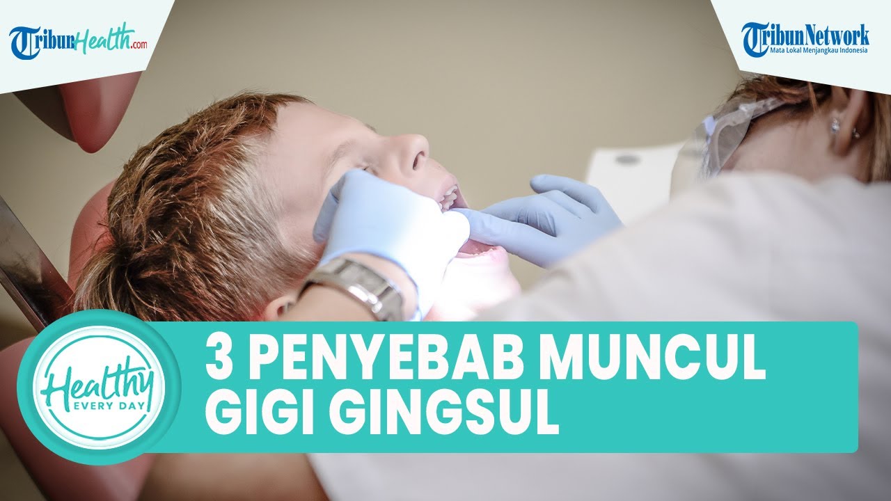 3 Penyebab Munculnya Gigi Gingsul yang Jarang Diketahui, Simak Ulasan ...