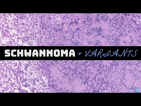 Schwannoma & Variants | Spindle Cell Unknowns (Case #1) | #BSTPATH Cases for Residents