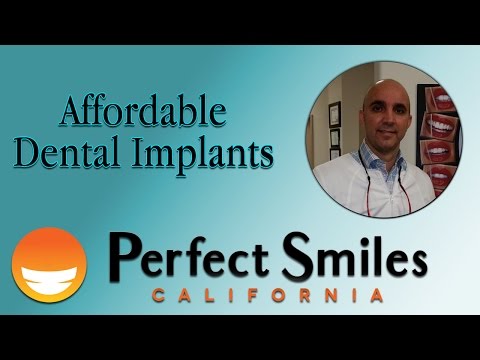 Chula Vista CA Affordable Dental Implants| Dentist Chula Vista CA Implants|Dr. David Garate