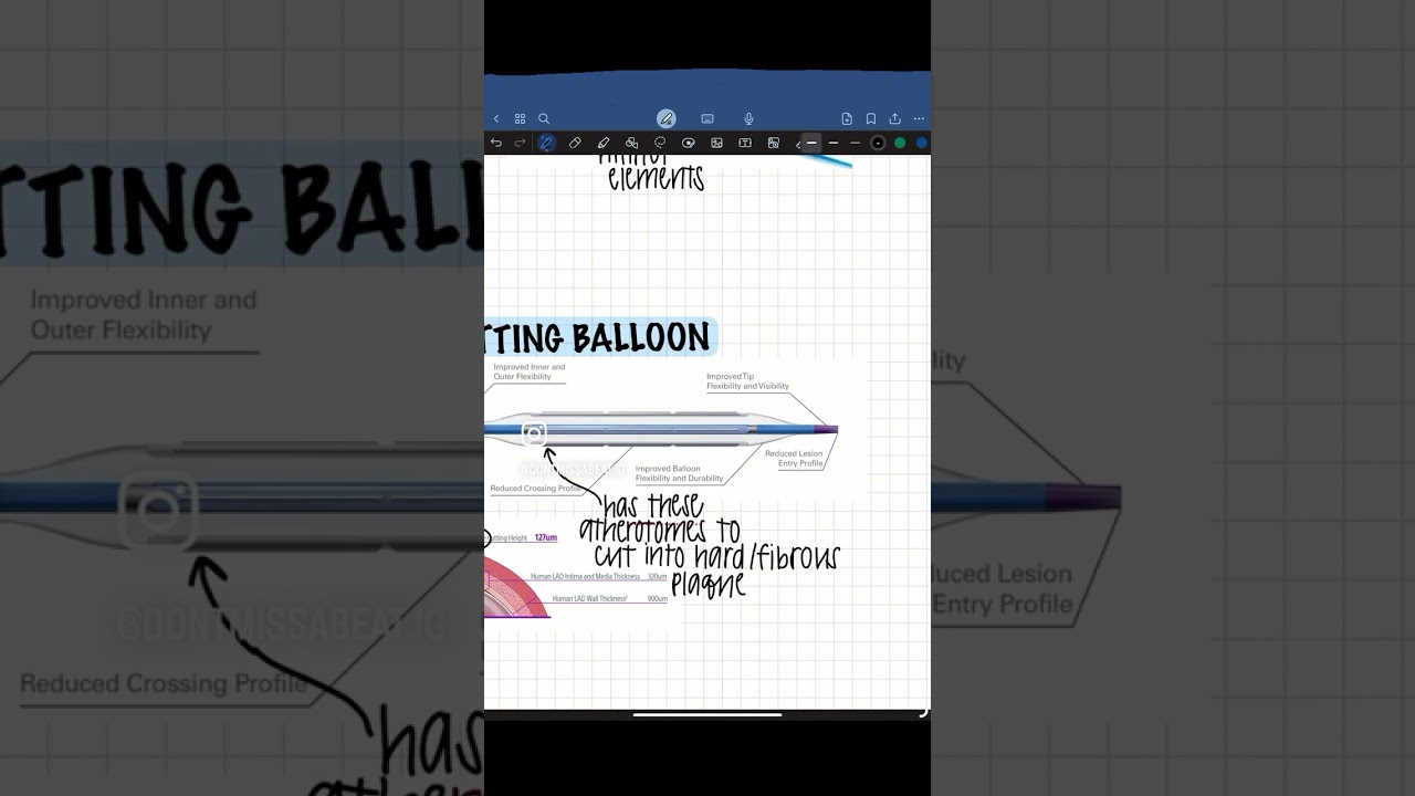 Cutting and Scoring Balloons