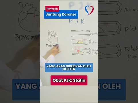 Obat PJK: STATIN (selengkapnya lihat related video) #jantung