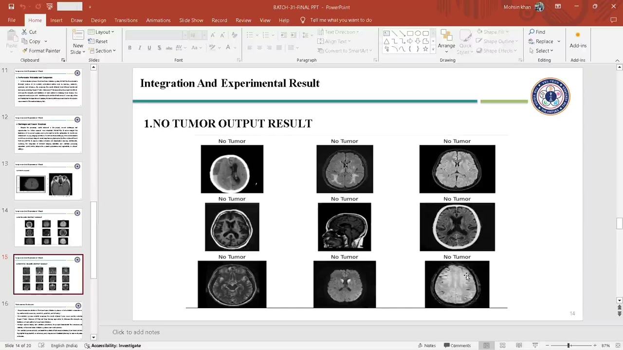 BRAIN TUMOR DETECTION USING IMAGE PROCESSING WITH PYTHIN AND SCIKIT LEARN