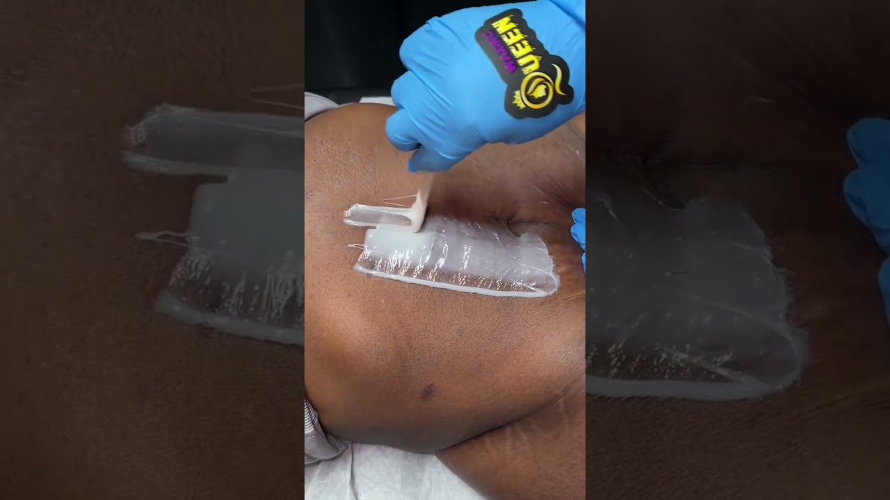 Full stomach wax with 50/50 Russian Pearl and Sensi Clear wax mix Bare Beauty Wax Supply got it all!