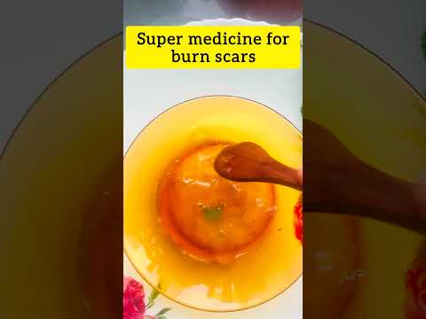 How to remove burn scars easily in home || face and skin softness home remedy