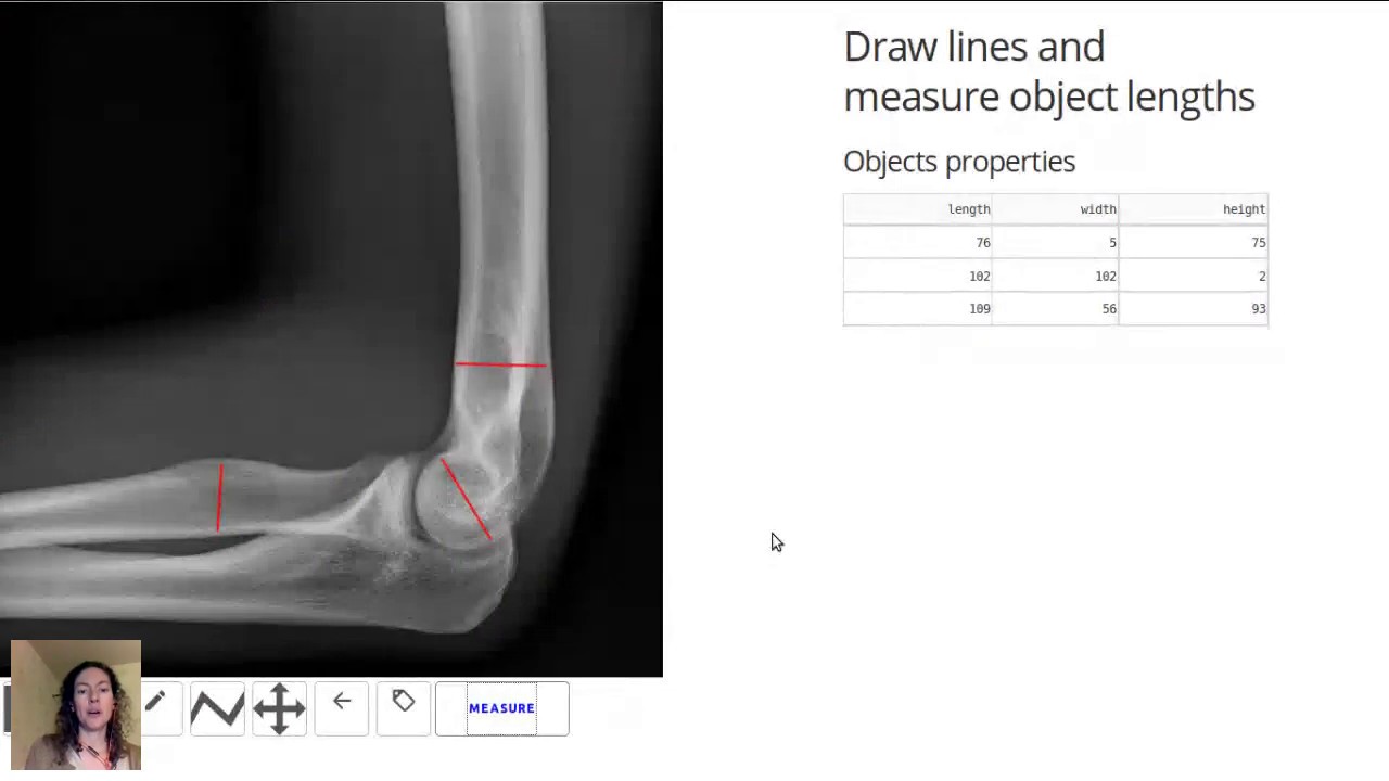 Interactive Image Processing with Dash-Canvas