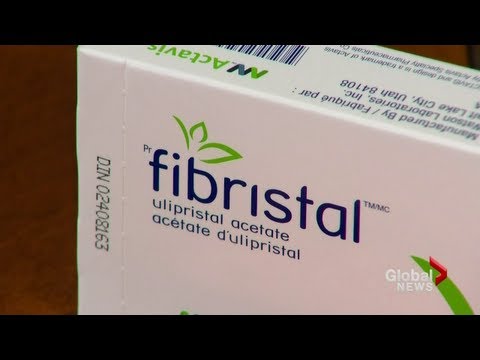 New fibroids drug treatment