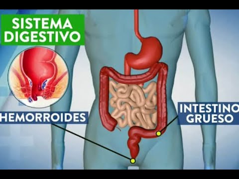 Hemorroides, ¿qué son, por qué salen y cómo curarlas?